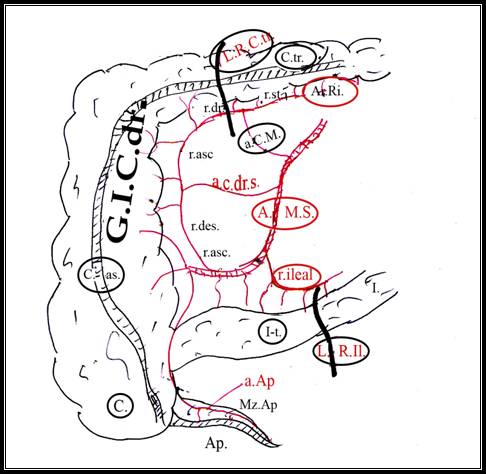 Reconversiunea duodenului prin interpunerea ileocolonului drept intre ...