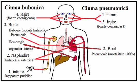 Boli transmise de purici - Ciuma